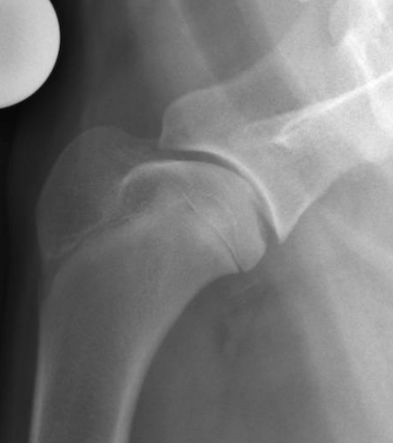 Clinical Image: What Is Affecting This Dog's Shoulder?