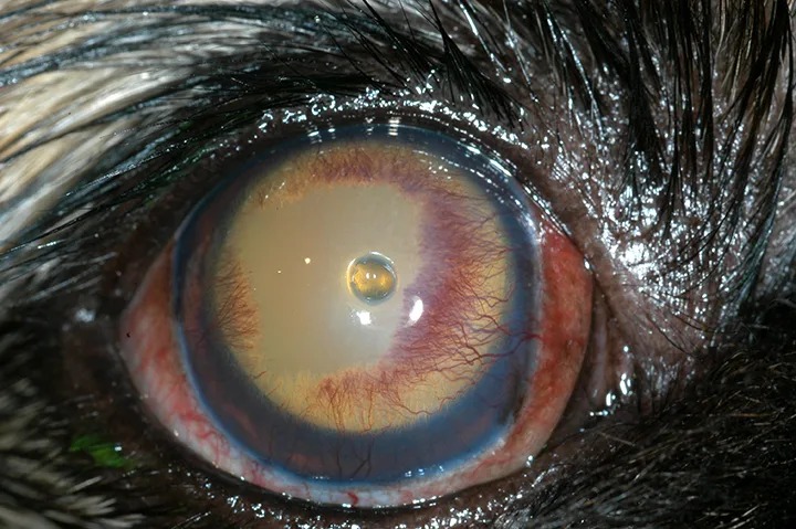 Clinical Image: Ocular Lesion
