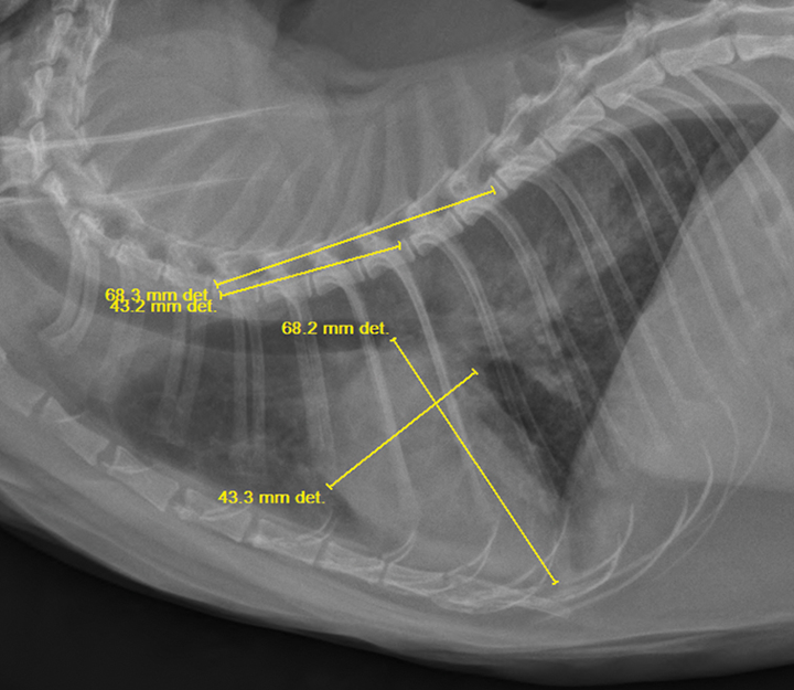 Left-Sided Congestive Heart Failure | Clinician's Brief