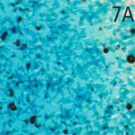 Fungal Cultures for Diagnosing Dermatophytosis | Clinician's Brief