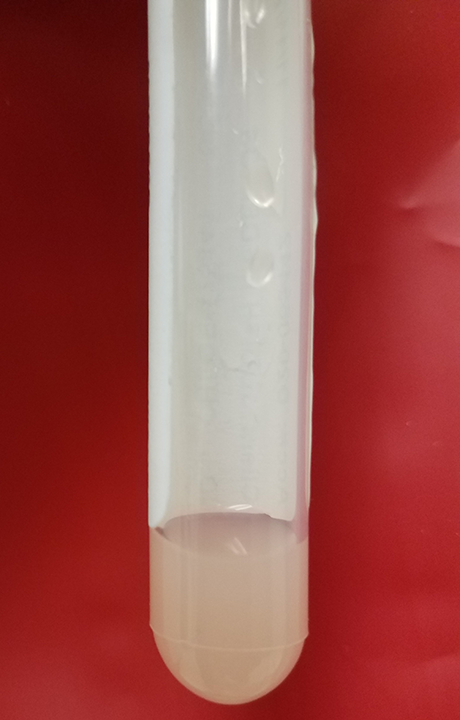 Top 5 Blood Collection & Sampling Errors | Clinician's Brief