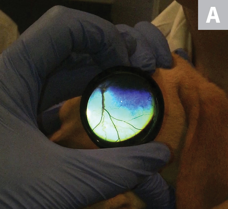 Smartphone Technology in Clinical Ophthalmology | Clinician's Brief