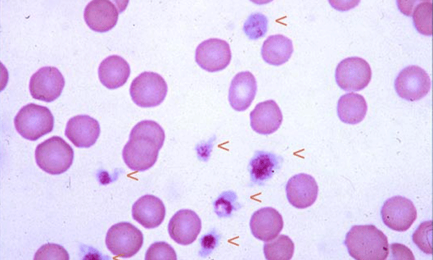 Evaluating the Bleeding Patient: Point-of-Care Tests