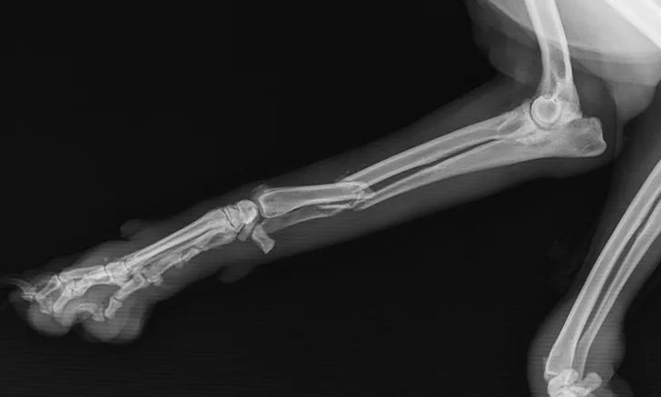 Surgery, Soft Tissue