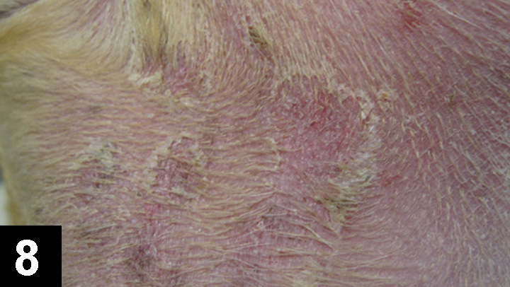 Scaling & Crusting Skin Disease | Clinician's Brief