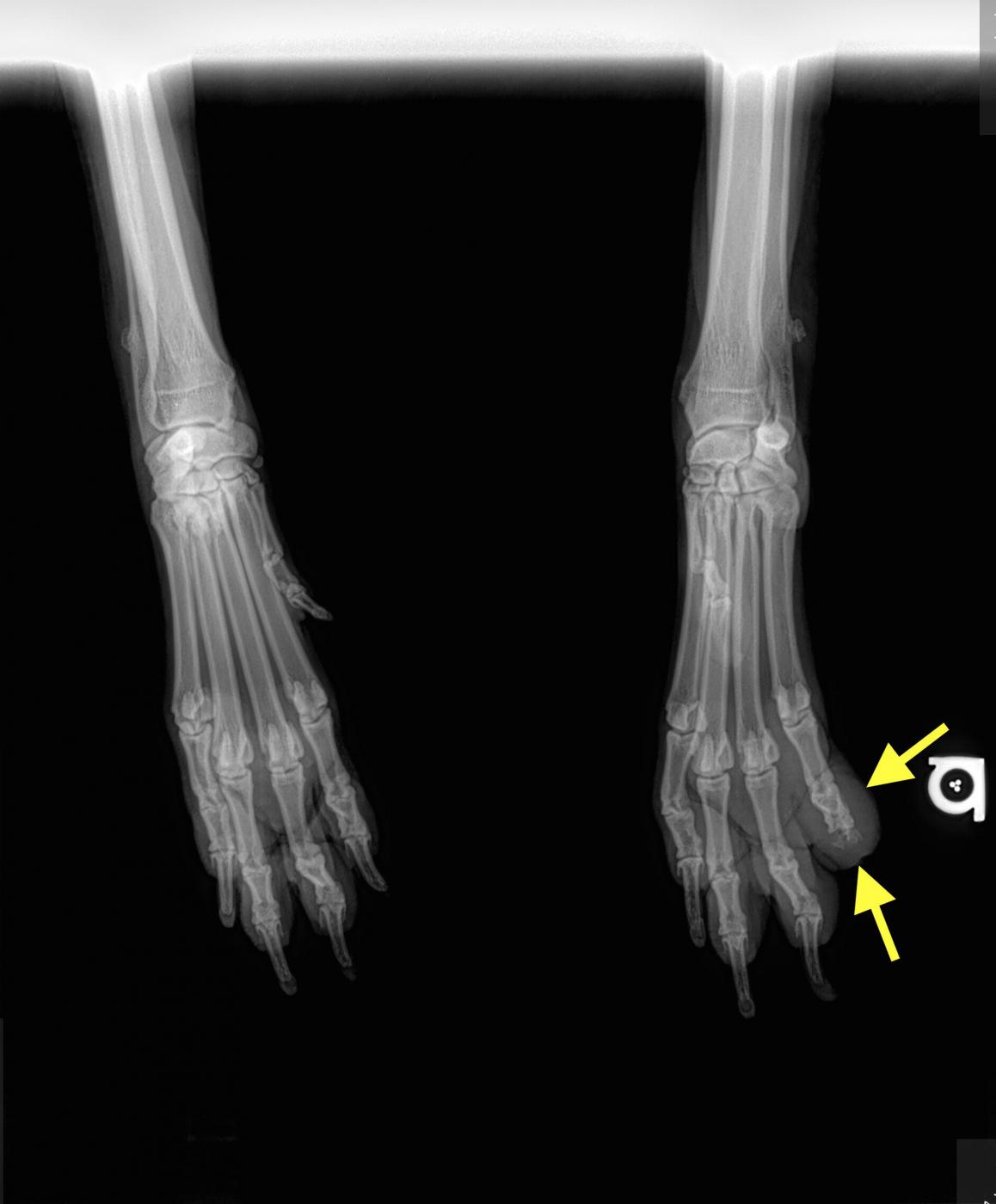 Image Gallery: Primary & Metastatic Tumors Part 1 | Clinician's Brief