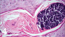 Chin Dermatitis in a Cat | Clinician's Brief