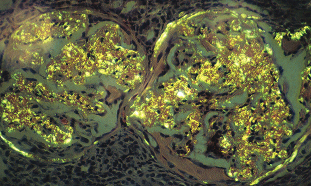Signs & Pathology of Shar-Pei Fever | Clinician's Brief