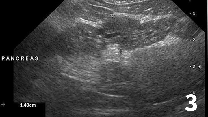 Triaditis Syndrome | Clinician's Brief
