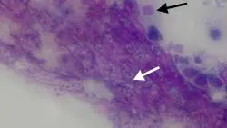 Corneal Cytology & Culture Collection