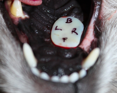 Oronasal Fistulae at a Glance | Clinician's Brief