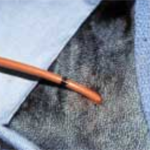 How To Place An Esophagostomy Tube | Clinician's Brief