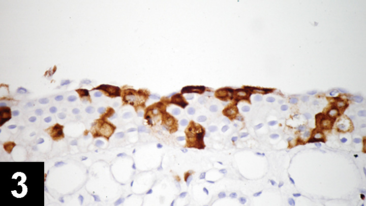 Canine Distemper Virus | Clinician's Brief