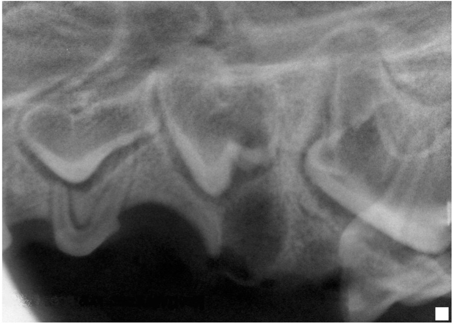 Clinical Image: What Does This Dental Radiograph Demonstrate?