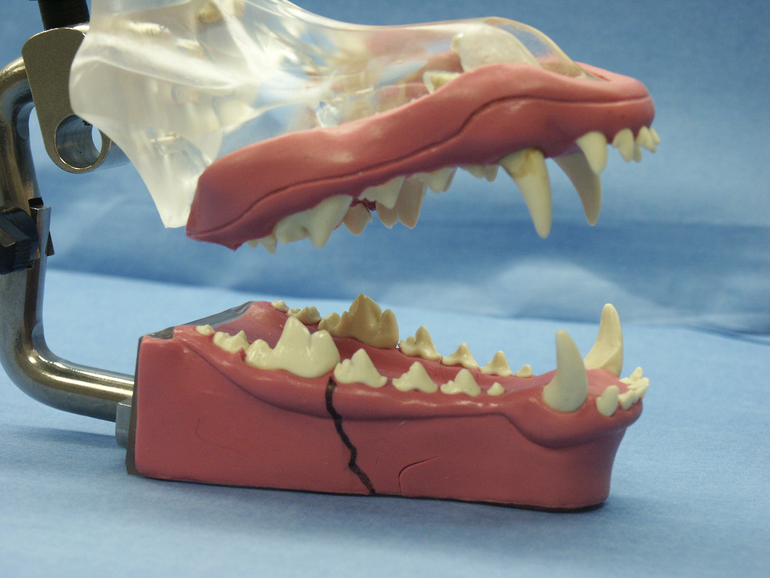 Acrylic for Repair of Mandibular Fractures