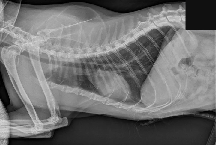 Clinical Image: Cardiac Sternal Contact