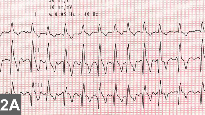 Top 5 Arrhythmias in Dogs & Cats | Clinician's Brief