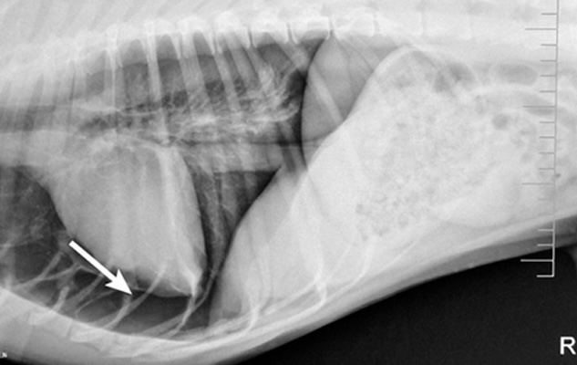 Clinical Image: Classic Radiographic Sign