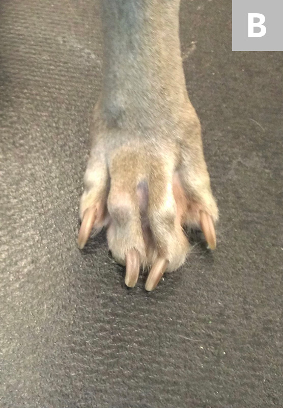 Bandaging Complications | Clinician's Brief