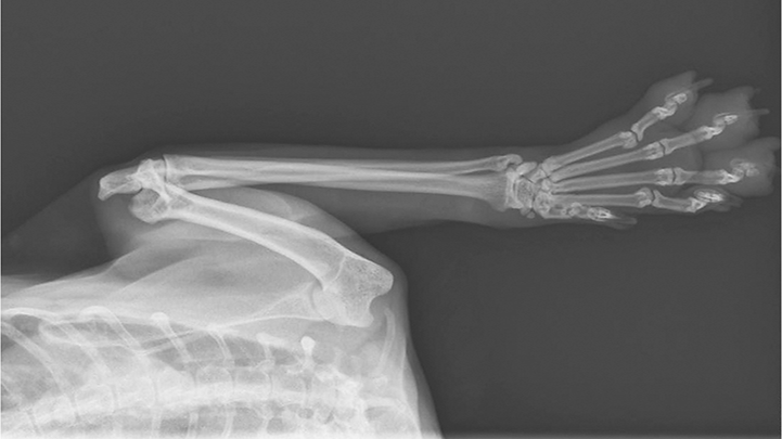 Pulmonary Neoplasia & Digital Metastasis in Cats | Clinician's Brief