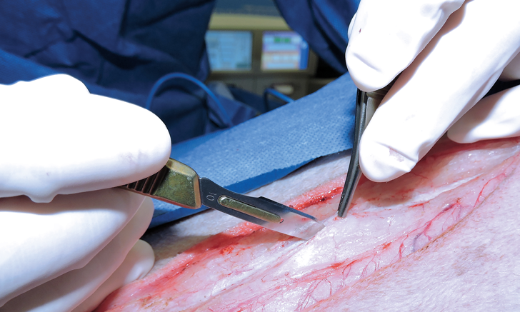 Midline Celiotomy: Linea Alba & Paramedian Incisions