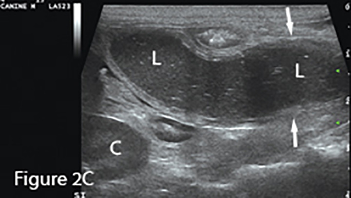 Imaging Intestinal Obstruction | Clinician's Brief