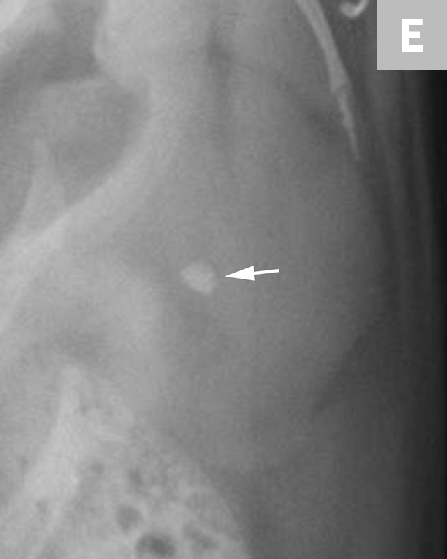 Diagnostic Imaging of Urinary Tract Calculi | Clinician's Brief