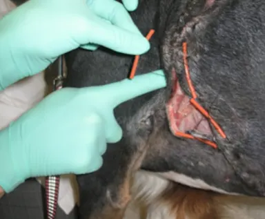 Managing Degloving & Shearing Injuries: Step-by-Step Guide