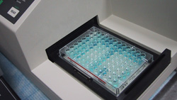 New Tests for Pancreatitis | Clinician's Brief