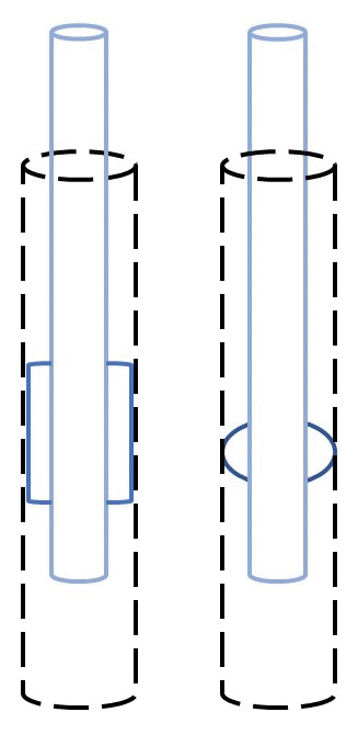 Excessive Endotracheal Tube Cuff Pressure | Clinician's Brief