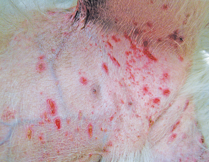 Top 5 Causes of Nonblanching Skin Lesions | Clinician's Brief