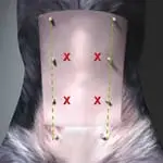 How to Perform an Abdominocentesis on a Dog: Step-by-Step