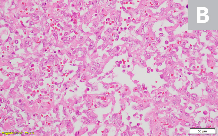 Canine Hemangiosarcoma | Clinician's Brief