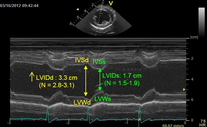Echocardiography in General Practice: Cardiac Abnormalities | Clinician ...