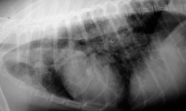 Pulmonary Thromboembolism