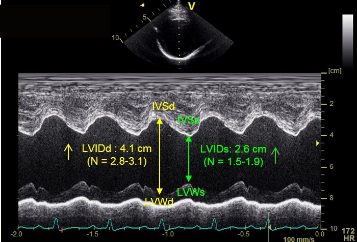 Echocardiography in General Practice: Cardiac Abnormalities | Clinician ...