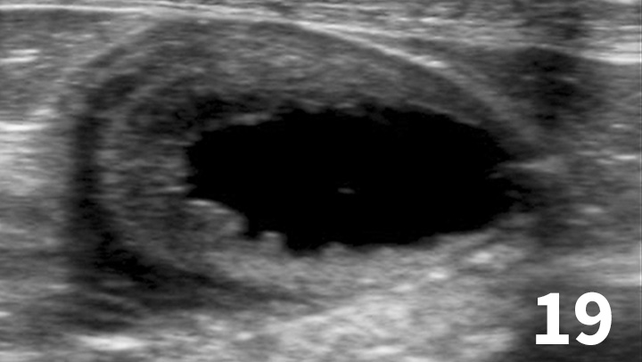 Imaging the Urinary Tract | Clinician's Brief