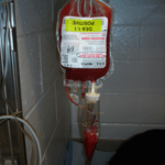 Blood Transfusion Basics | Clinician's Brief