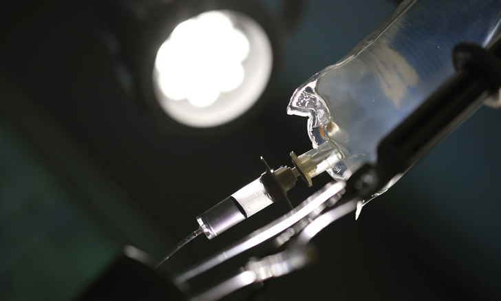 Monitoring IV Fluid Therapy