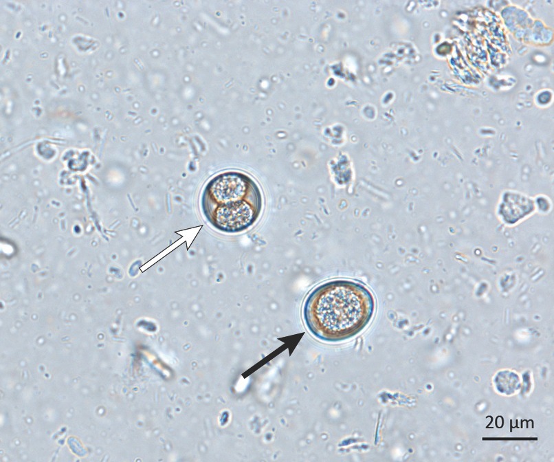 Clinical Image: Canine Stool Sample