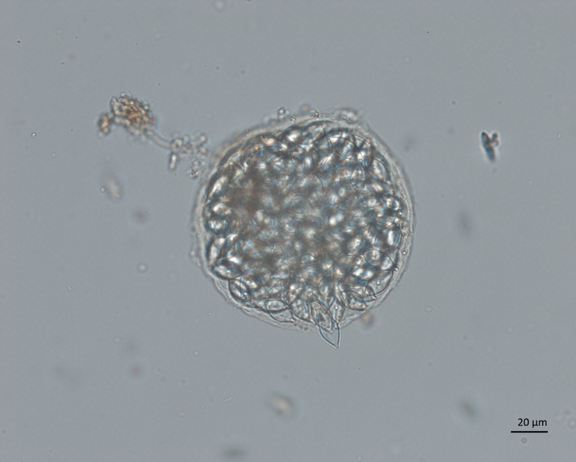 Clinical Image: What Is This Object From a Fecal Examination in a Dog?