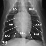 Interpreting Small Animal Thoracic Radiographs | Clinician's Brief