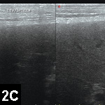 Hemangiosarcoma in a Dog | Clinician's Brief