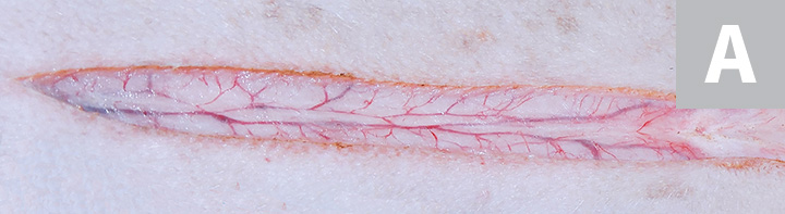 Identifying the Linea Alba & Avoiding Paramedian Incisions During ...