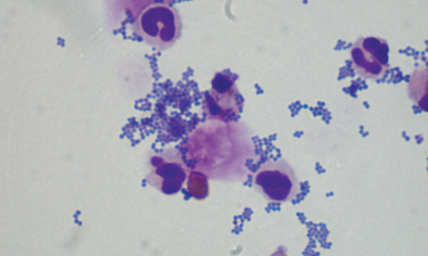 Importance & Usefulness of Urine Sediment Evaluation
