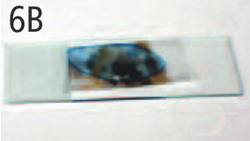 Fungal Cultures for Diagnosing Dermatophytosis | Clinician's Brief