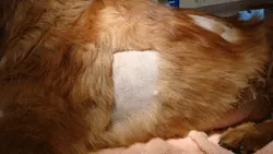 Guide to Performing Thoracocentesis | Clinician's Brief