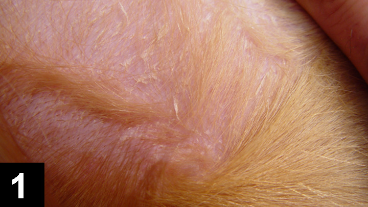 Scaling & Crusting Skin Disease | Clinician's Brief