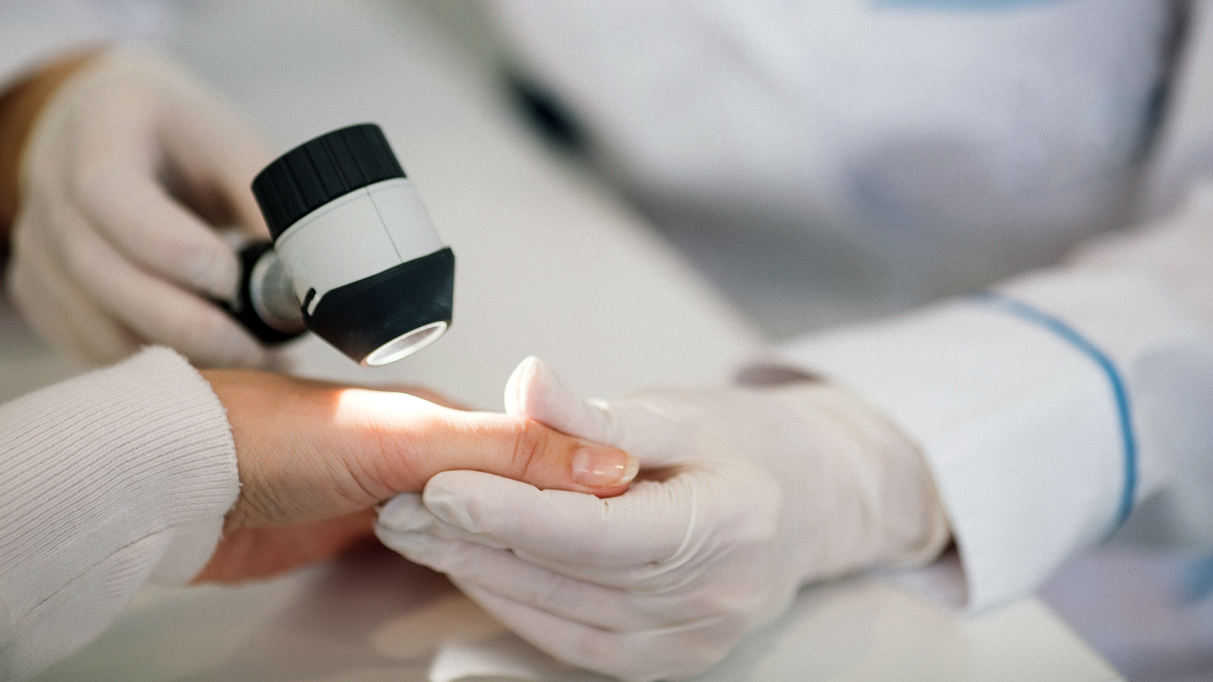 Squamous Cell Skin Carcinoma: Stages and Treatment - GoodRx