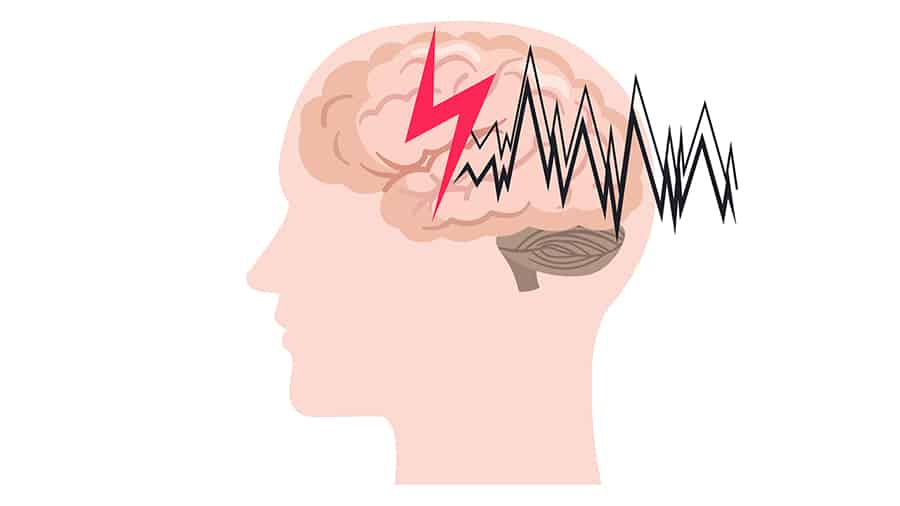 What Actually Happens to Your Body During a Seizure - GoodRx